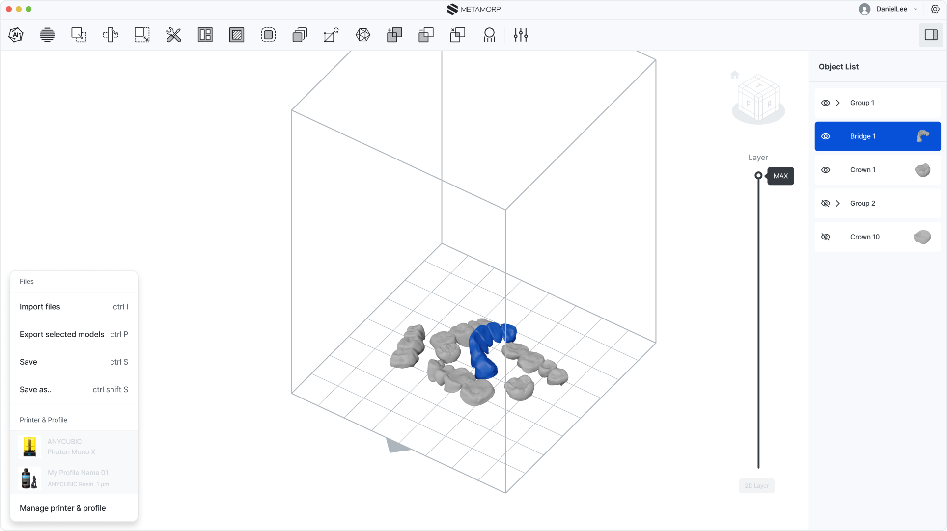 METAMORP | 메타몰프 - Optimizing Your Dental 3D Printing